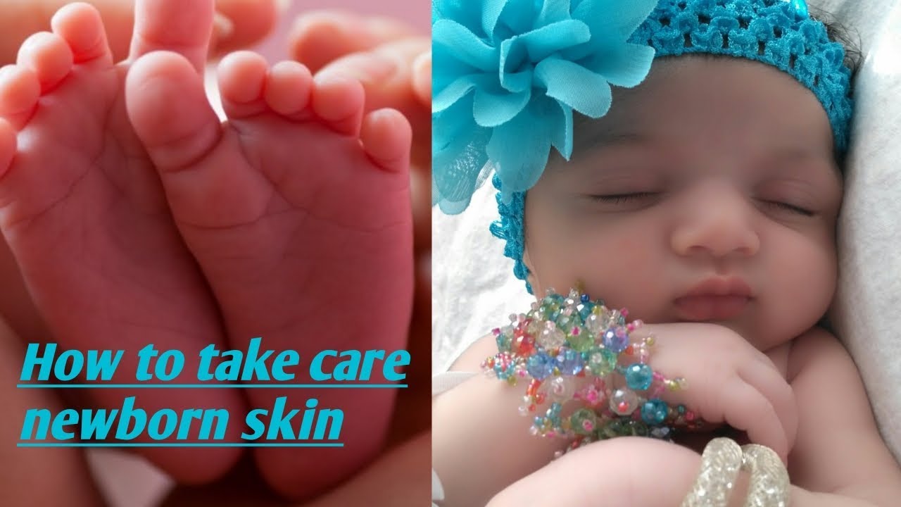 How To Reduce Newborn Baby's Dry Skin?/ Newborn Skin Care Tips(in ...