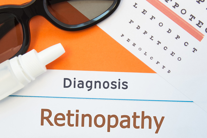 Retinopathy Of Prematurity (ROP): Stages, Causes & Treatment ...