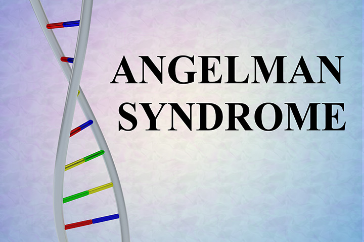 Angelman Syndrome: Symptoms, Causes And Treatment - UsParenting.com