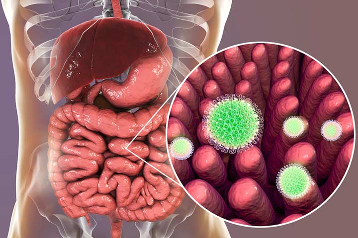 Symptoms Of Rotavirus In Children, Causes, Risks & Treatment ...